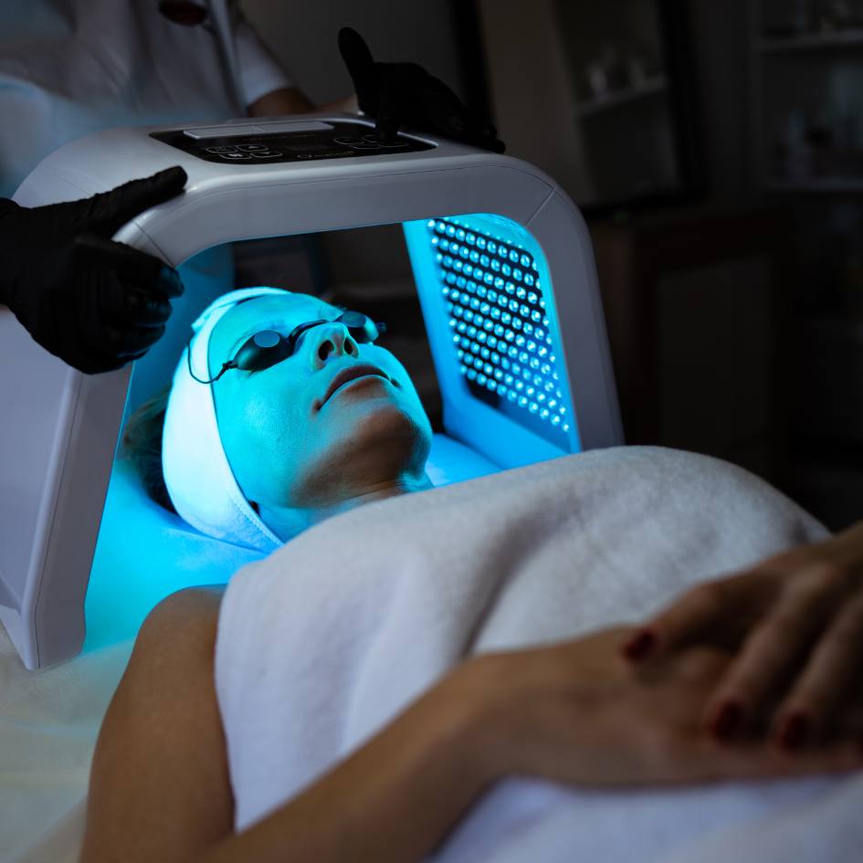 Photo Facial: Definition, Process, Benefits & Side Effects | Esthetica